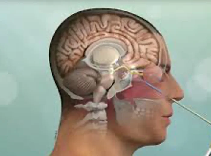 Get Best Endoscopic Brain Surgery Outcomes | IBS Hospital